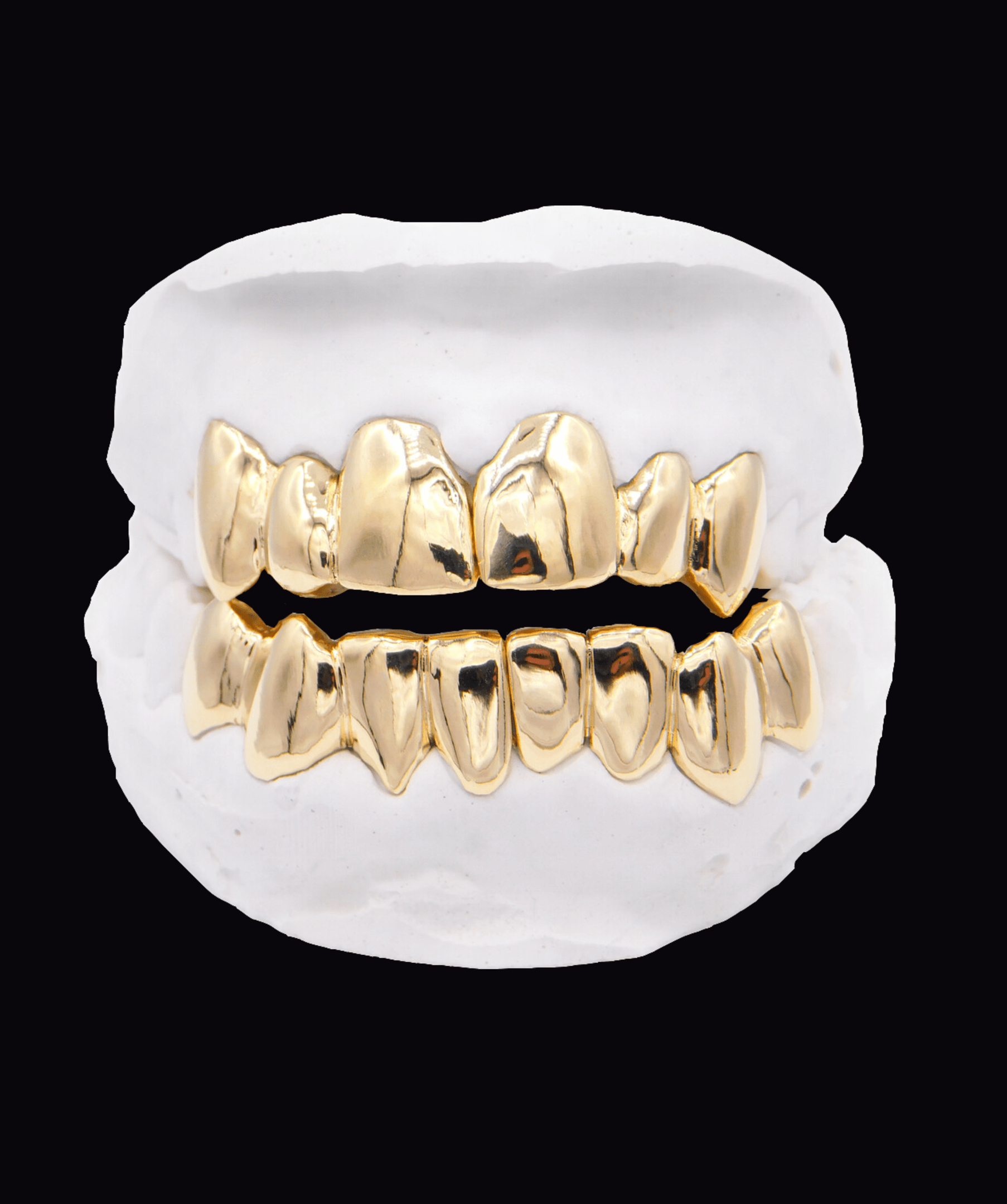 Upper & Lower Gold Grillz – ICED LONDON